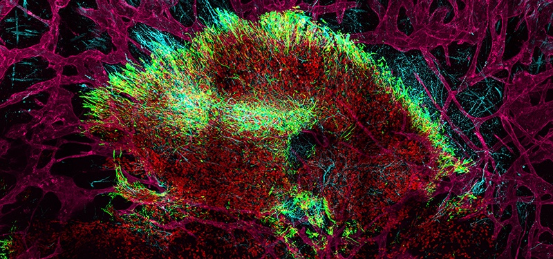 Lunenfeld-Tanenbaum Research Institute named Canada’s first Nikon ...